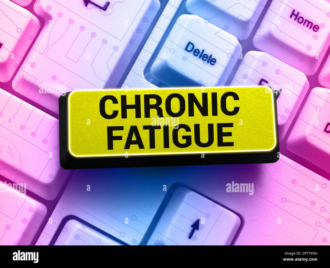 Sign displaying Chronic Fatigue. Business overview A disease or ...