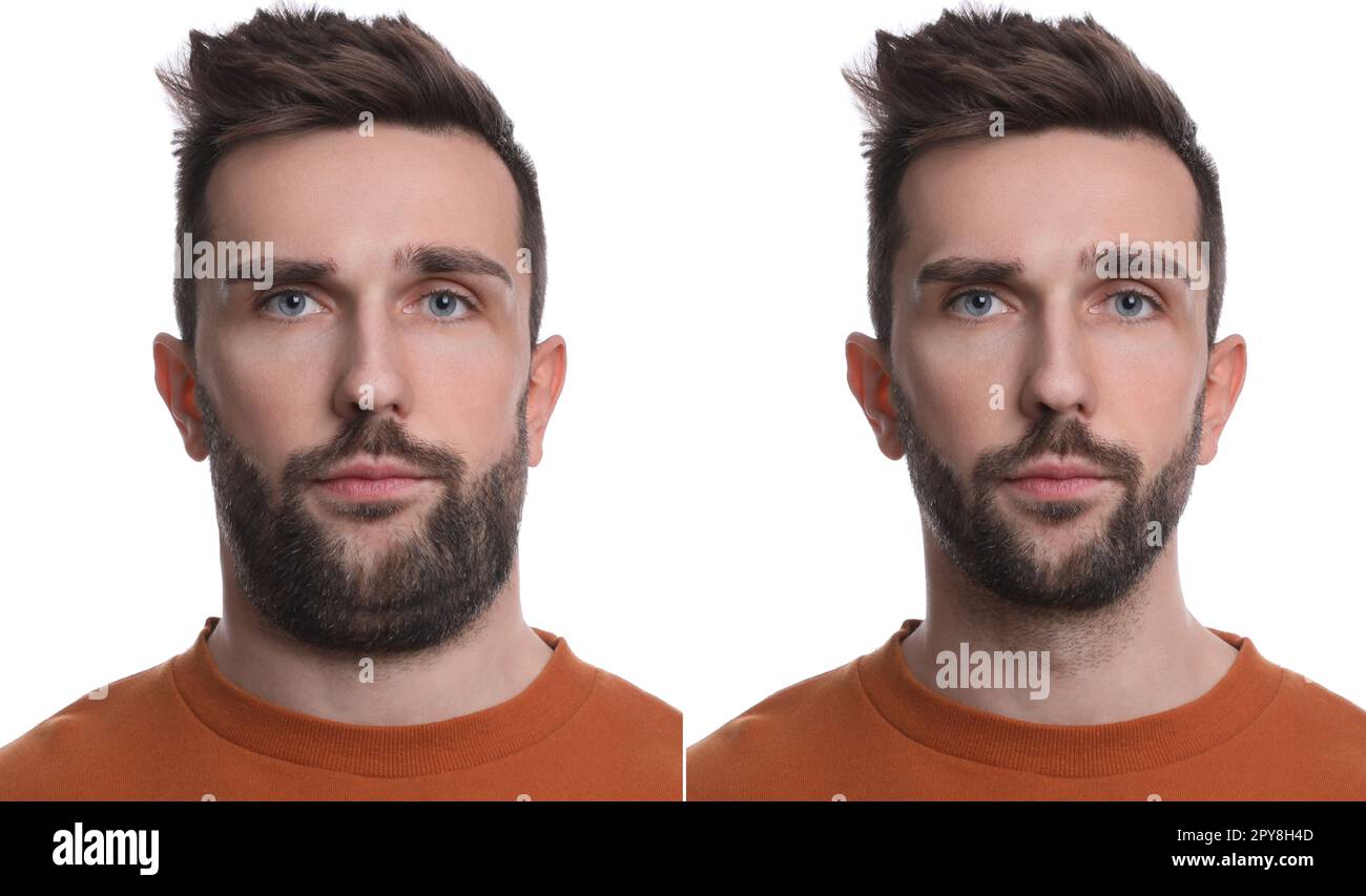 Double chin problem. Collage with photos of man before and after ...