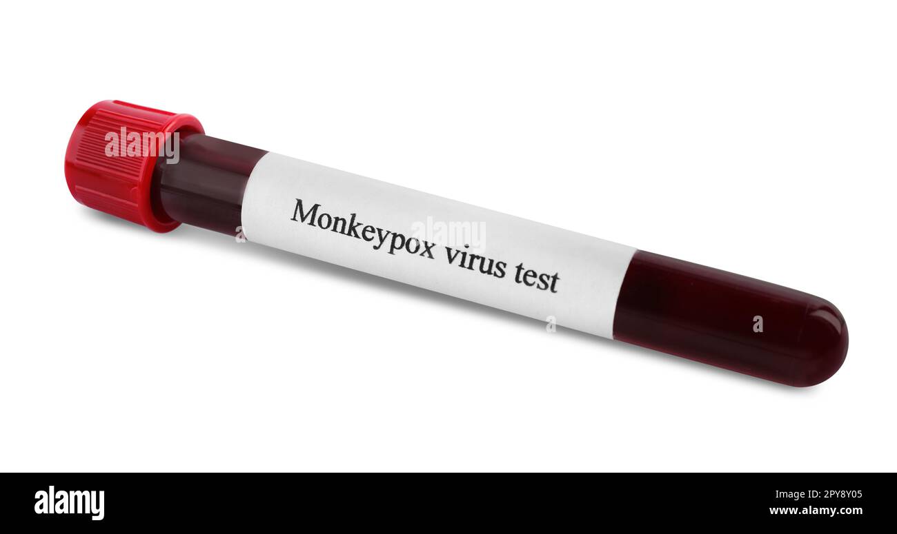 Monkeypox virus test. Sample tube with blood isolated on white Stock ...