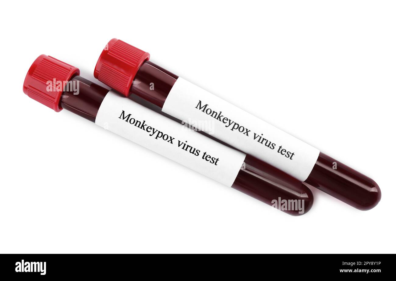Monkeypox virus test. Sample tubes with blood on white background Stock ...