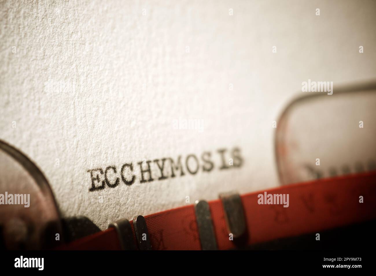 Ecchymosis word written with a typewriter Stock Photo - Alamy
