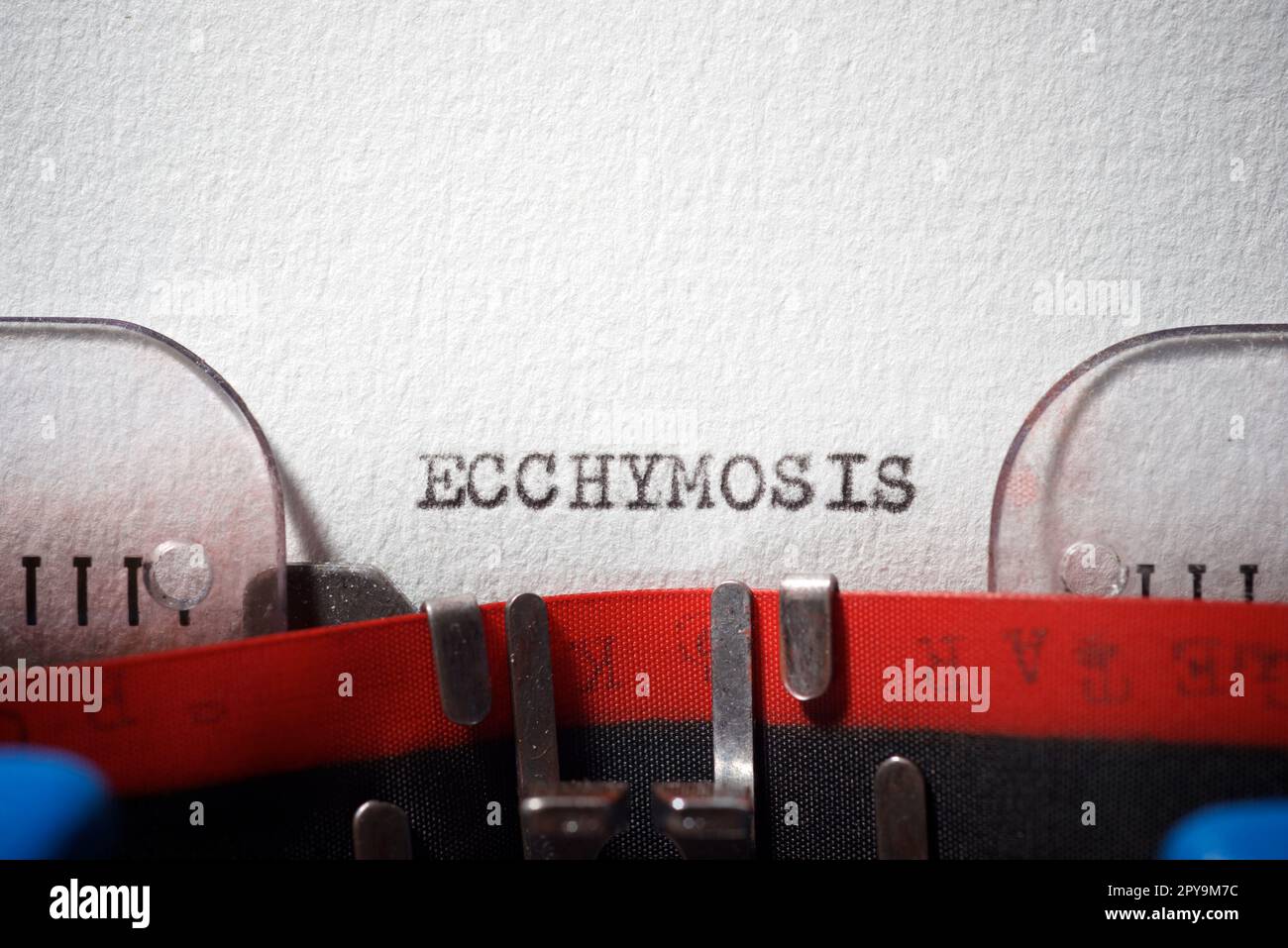 Ecchymosis word written with a typewriter Stock Photo - Alamy