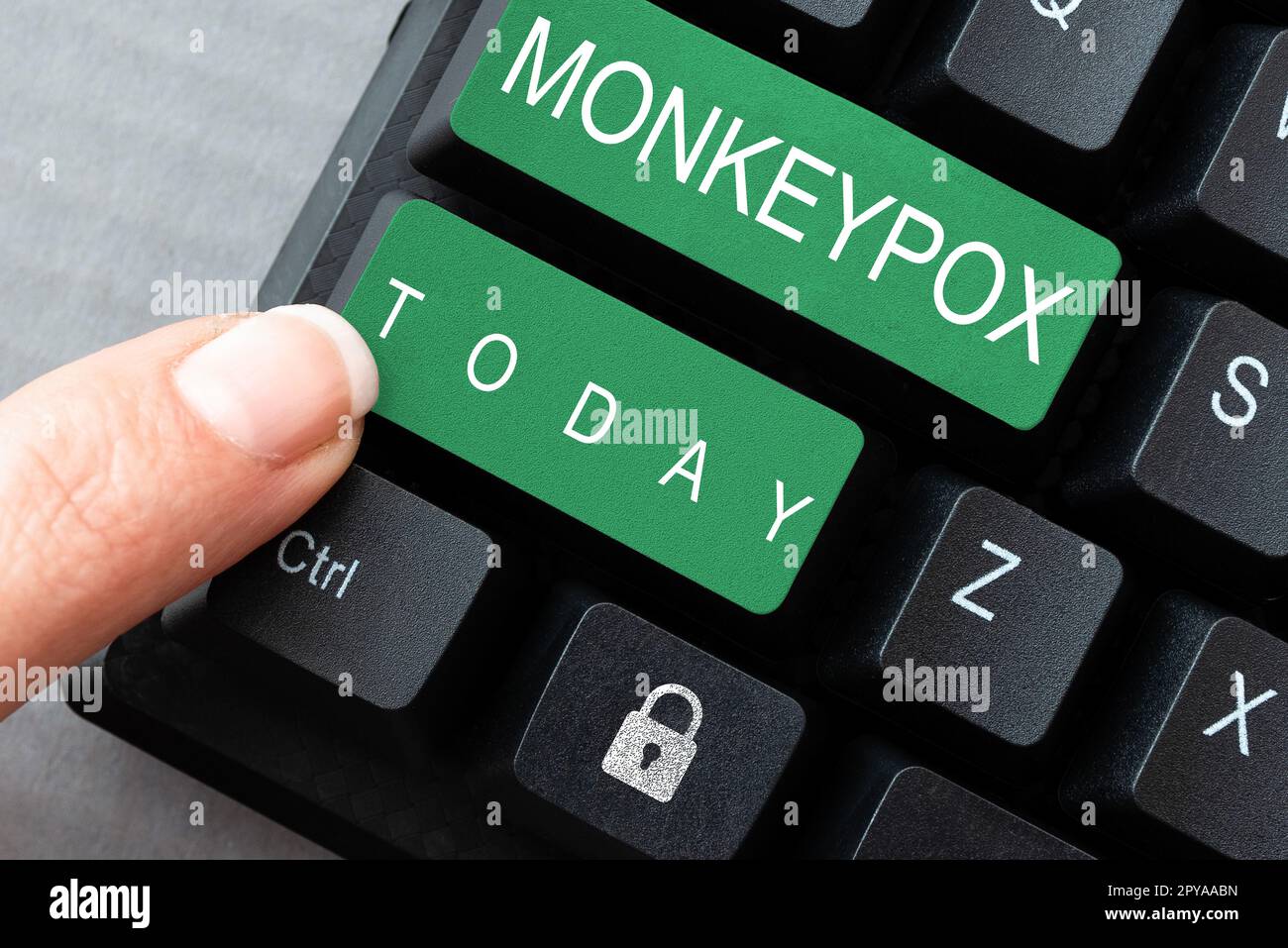 Text caption presenting Monkeypox. Concept meaning poxvirus of Africa ...