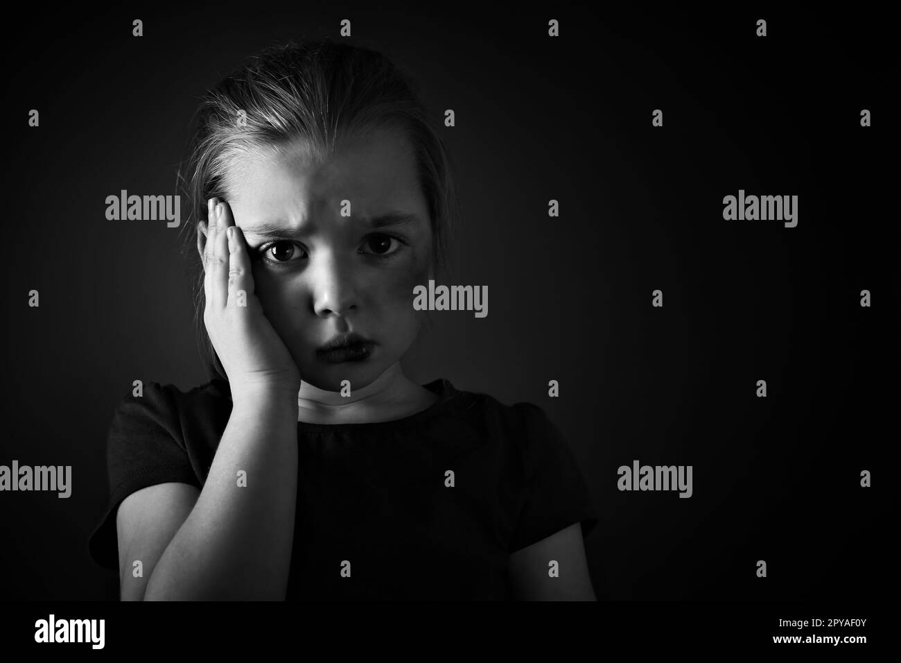 Little girl with bruises on face against dark background, space for ...