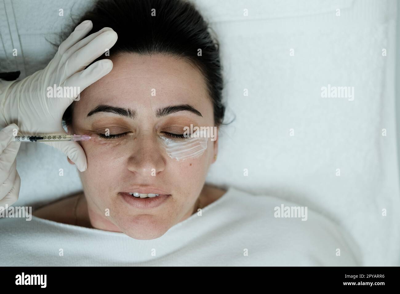 Top view of female patient having eye mesotheraphy applied Stock Photo ...