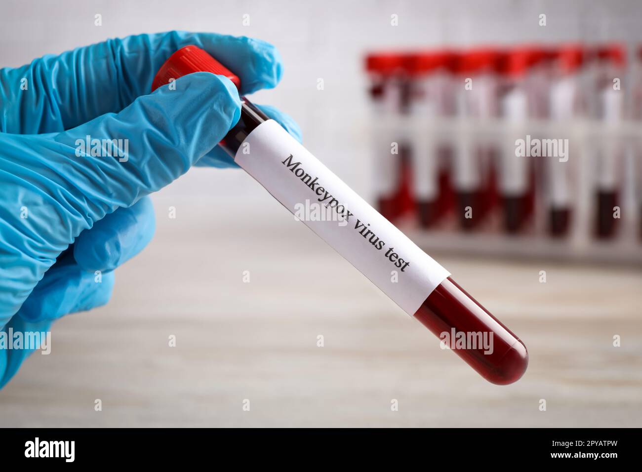 Worker holding blood sample hi-res stock photography and images - Alamy