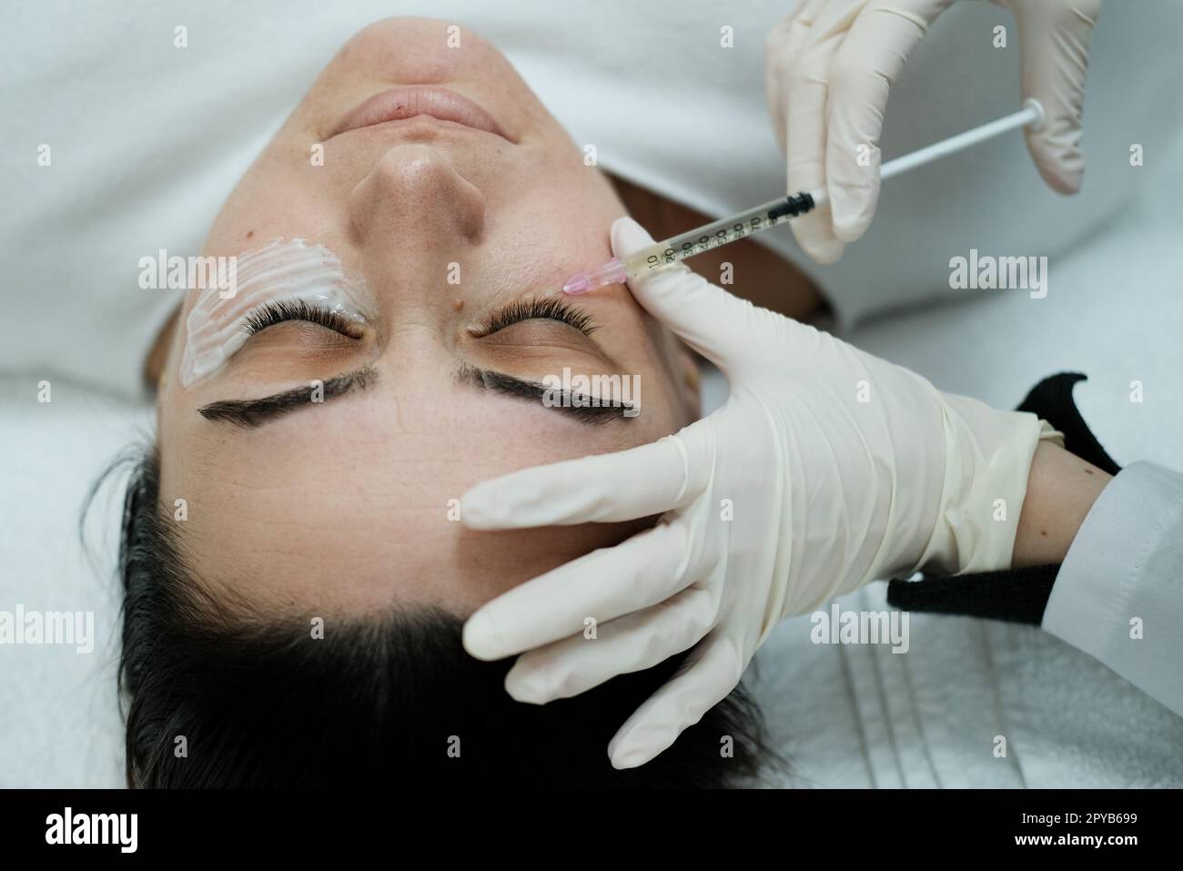 Top view of female patient having eye mesotheraphy applied Stock Photo ...