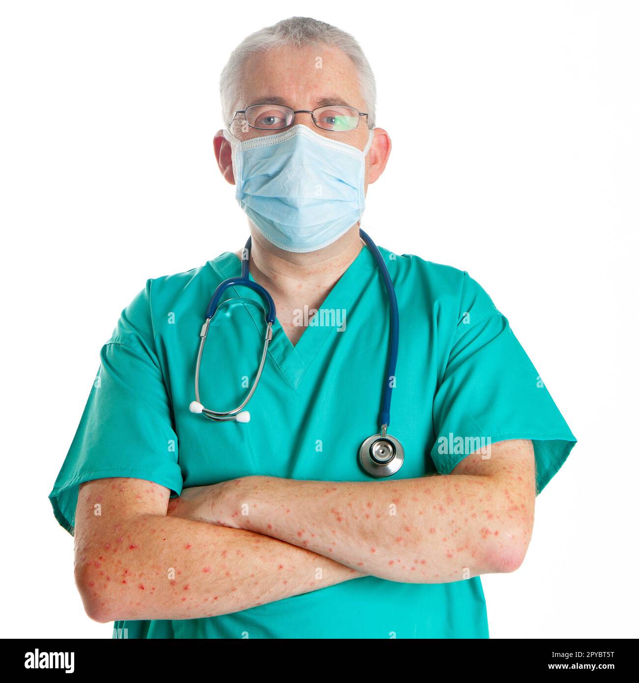 Shingles rash eye hi-res stock photography and images - Alamy