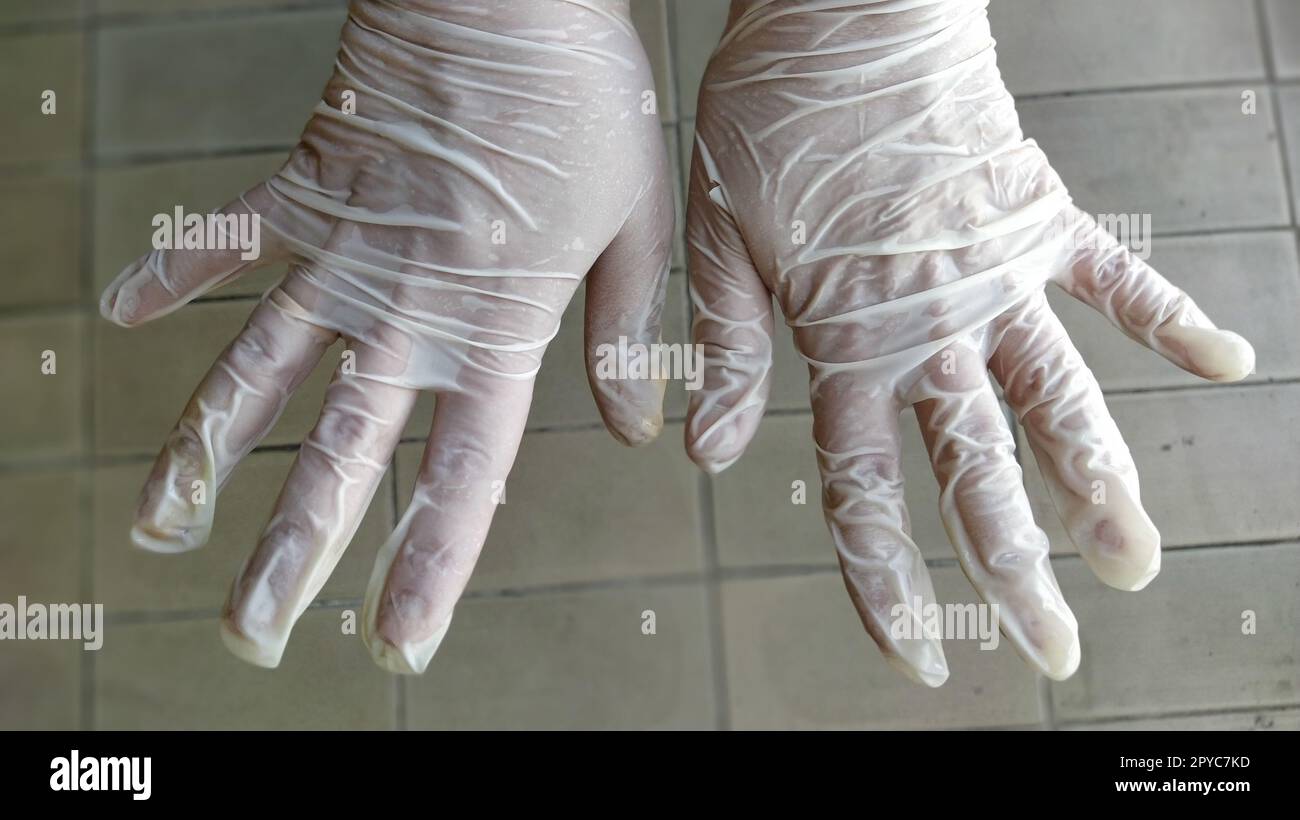 Hands in surgical gloves. Gestures, rubbing hands. Hand Wearing Medical ...