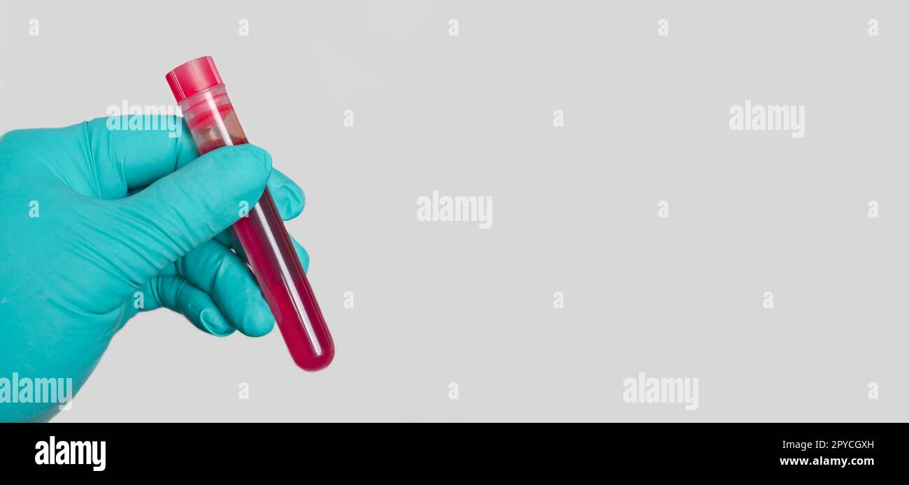 Gloved hand holding sample hi-res stock photography and images - Alamy