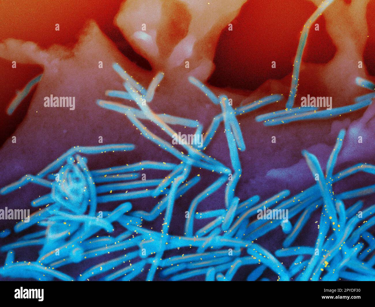 This electron microscope image provided by the National Institutes of ...
