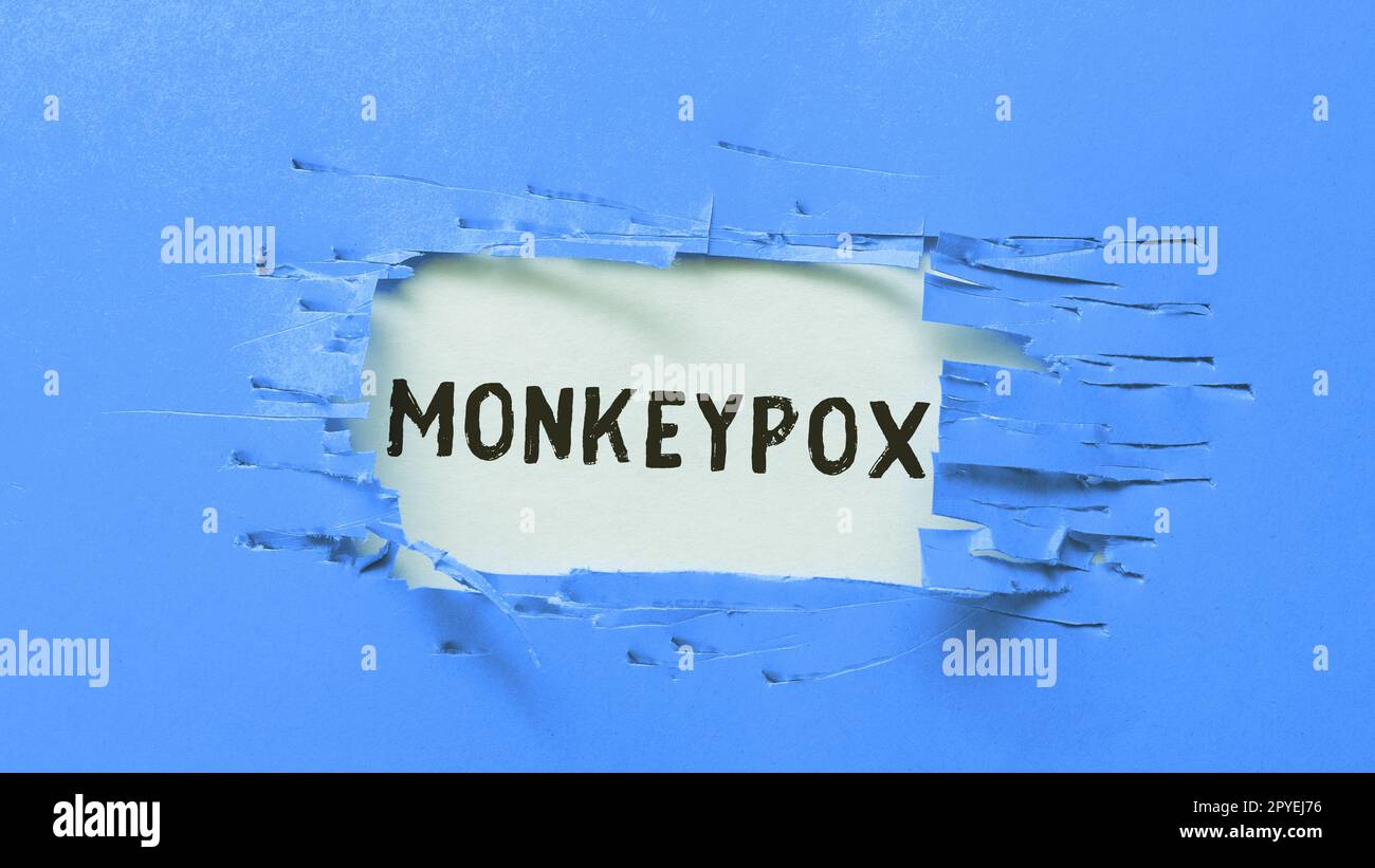 Inspiration showing sign Monkeypox. Word for poxvirus of Africa caused ...