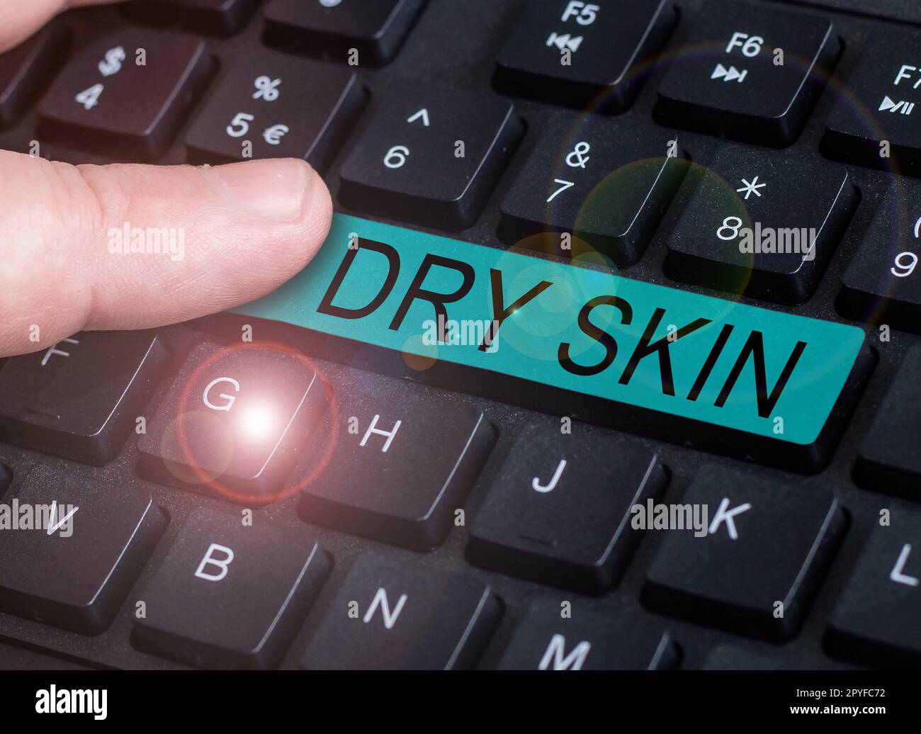 Text caption presenting Dry Skin. Concept meaning uncomfortable ...