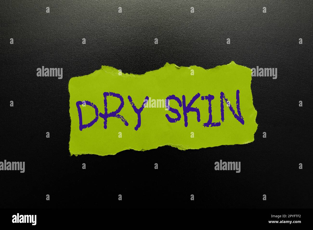 Writing displaying text Dry Skin. Business concept uncomfortable ...