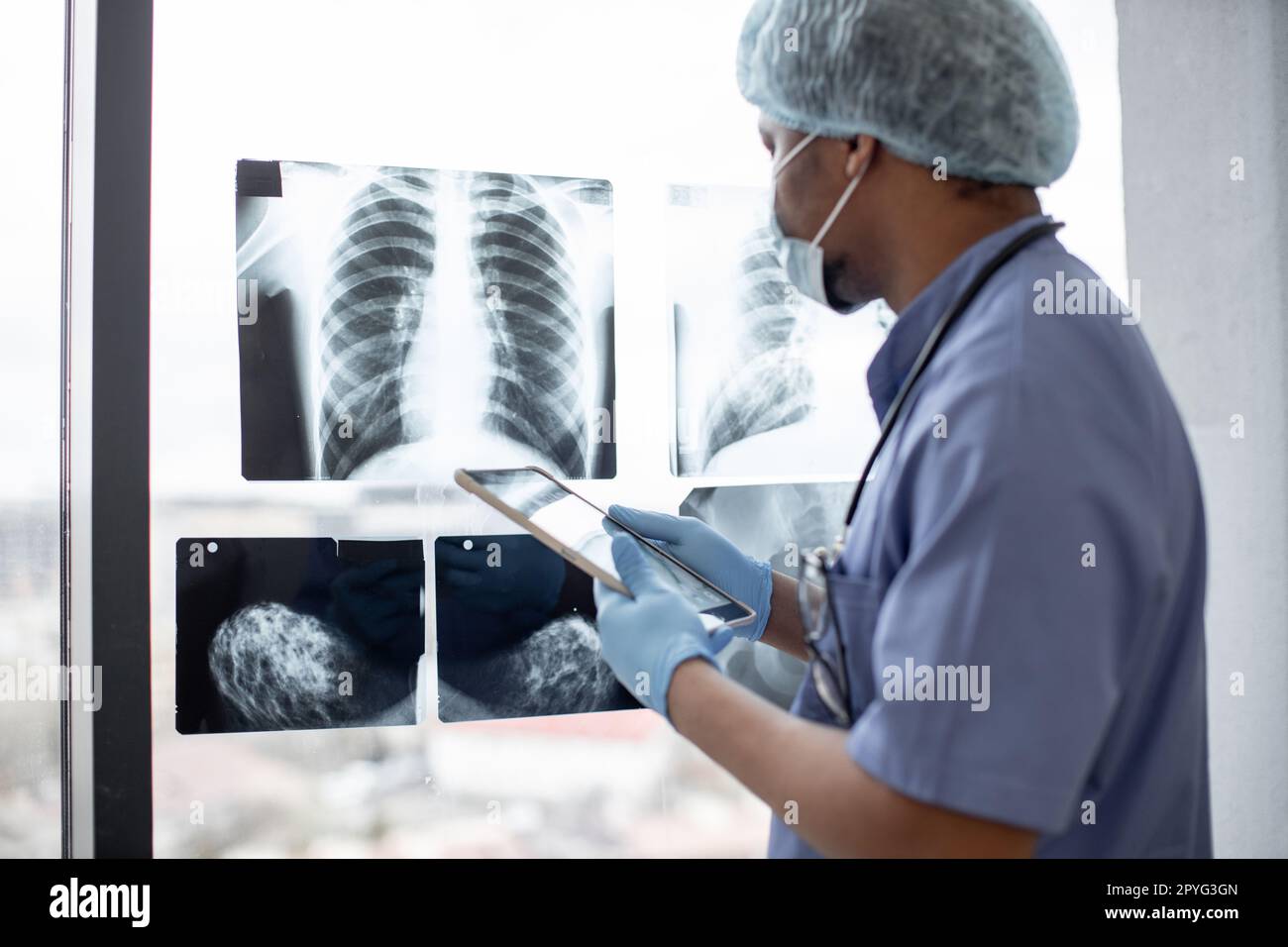 Focus on chest X-ray examination studied by multiracial healthcare ...