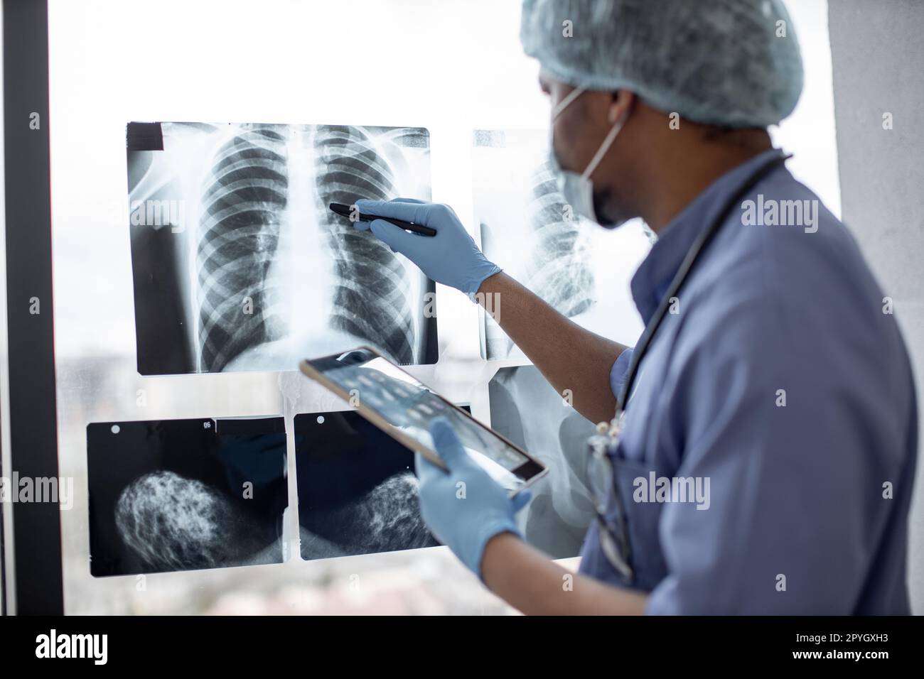 Focus on chest X-ray examination studied by multiracial healthcare ...