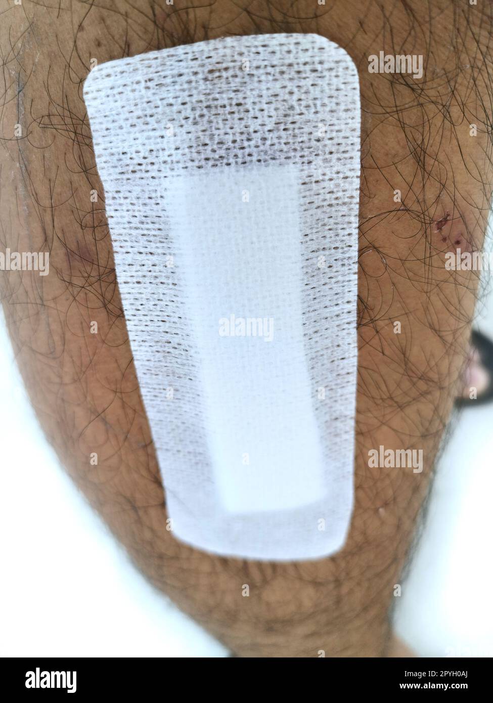 Adhesive plaster on patient's leg Stock Photo - Alamy