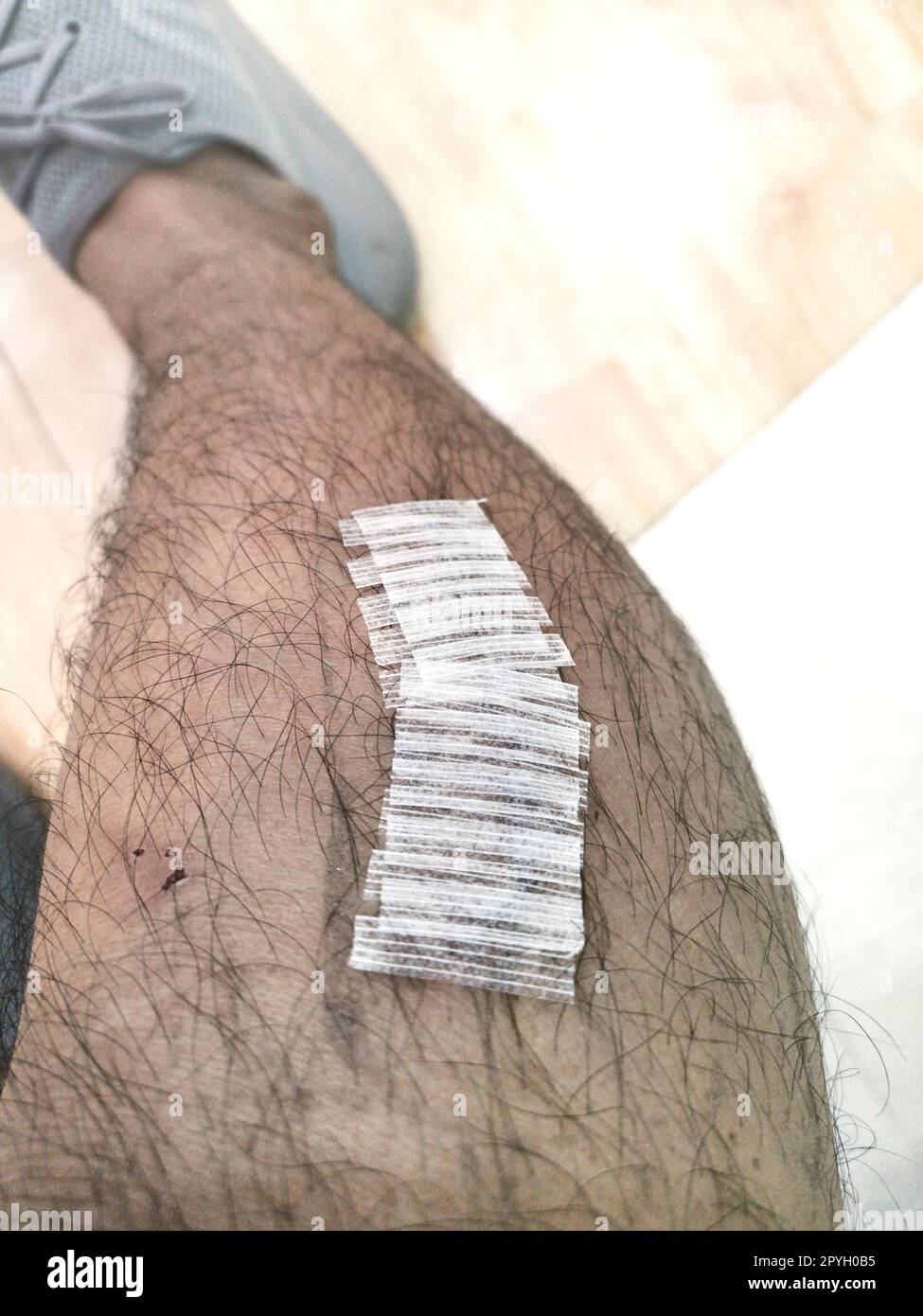 adhesive bandage on the lower leg Stock Photo - Alamy