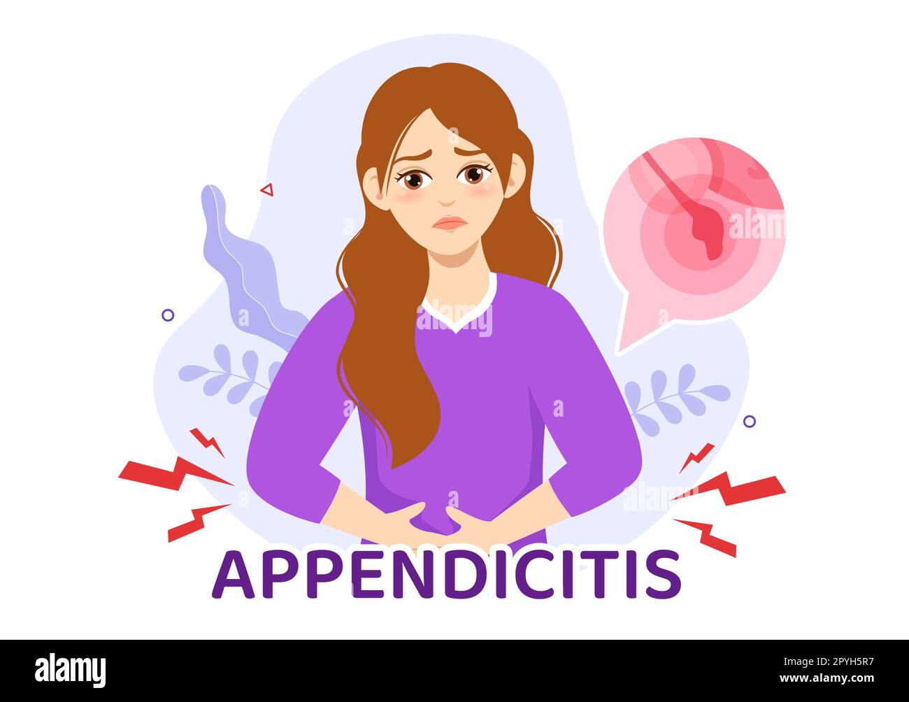 Appendicitis Illustration With Inflammation Of The Appendix And Stomach