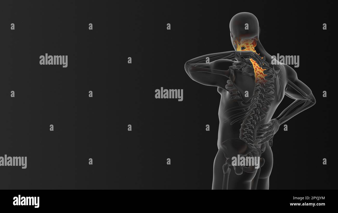 X ray of the neck of cervical vertebrae hi-res stock photography and images - Alamy