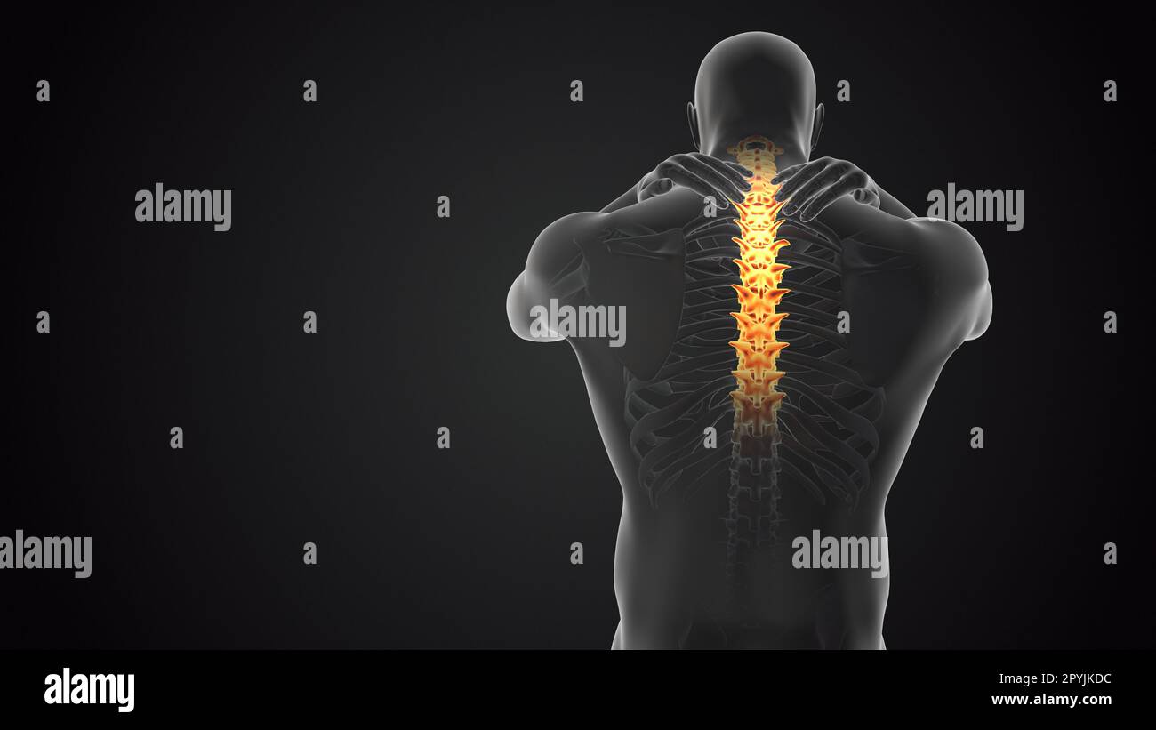 Neck joint and spine pain medical concept Stock Photo - Alamy
