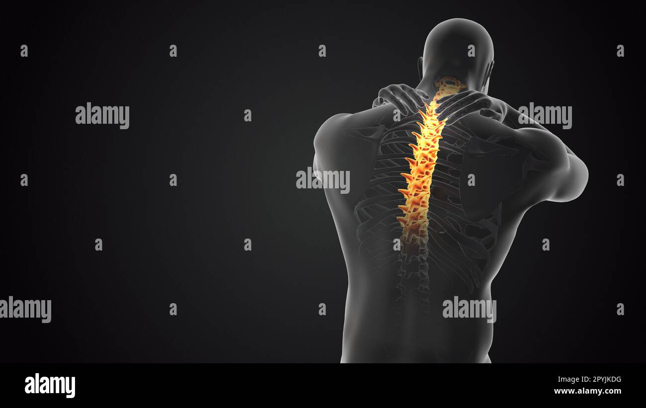 Spine back neck orthopedic hi-res stock photography and images - Alamy