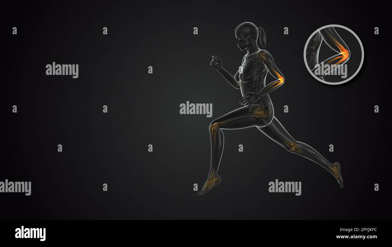 Joint pain therapy hi-res stock photography and images - Alamy