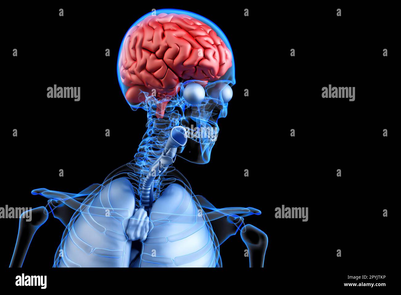 Diseased human brain. Anatomy concpet. 3D illustration Stock Photo - Alamy