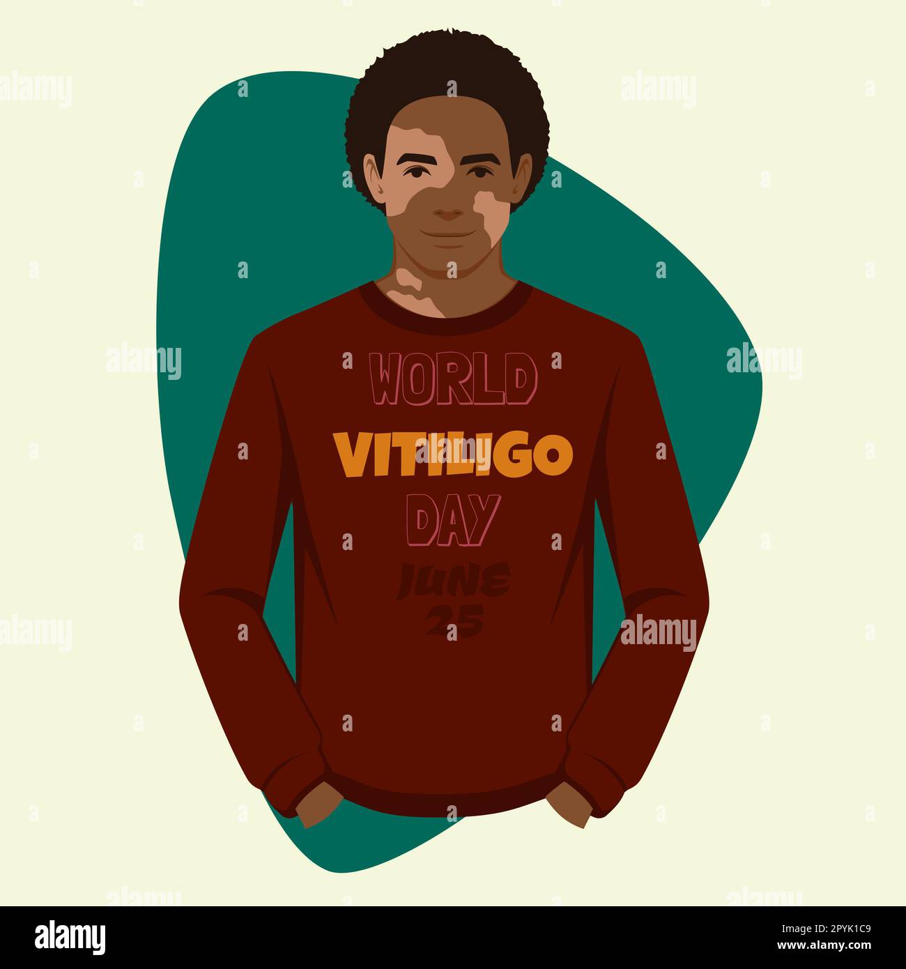 Vitiligo people isolated. Flat vector stock illustration. The concept ...