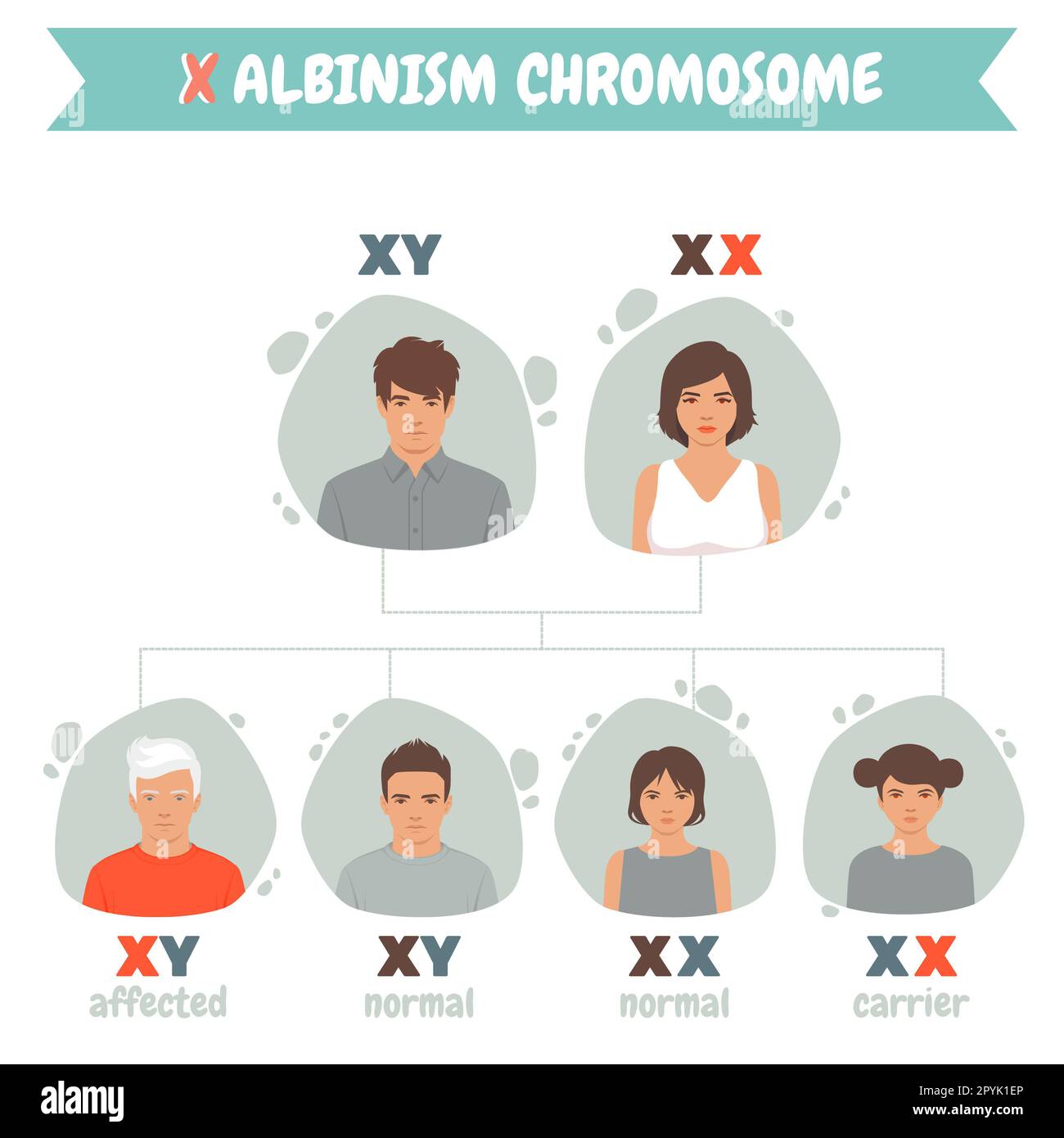 Albino people, men and women with albinism. Digital illustration of ...