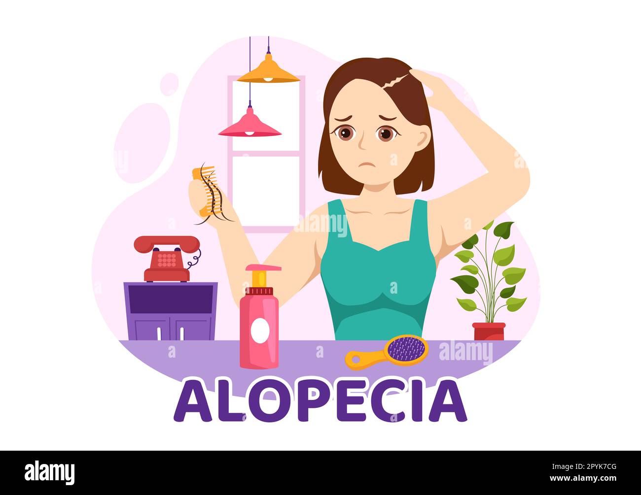 Alopecia Illustration with Hair Loss Autoimmune Medical Disease and ...