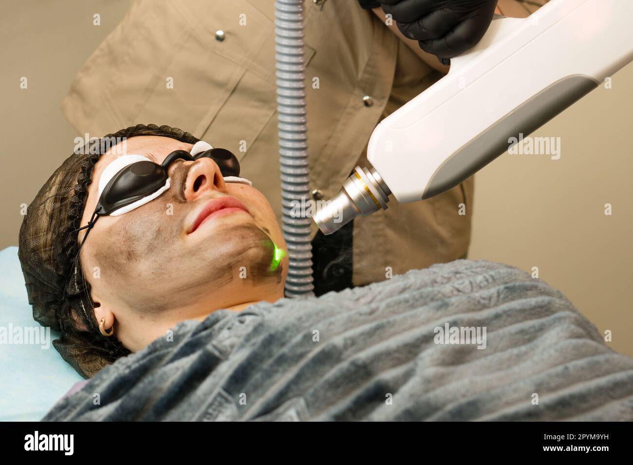 Carbon face peeling procedure in beauty salon. Laser pulses clean skin ...