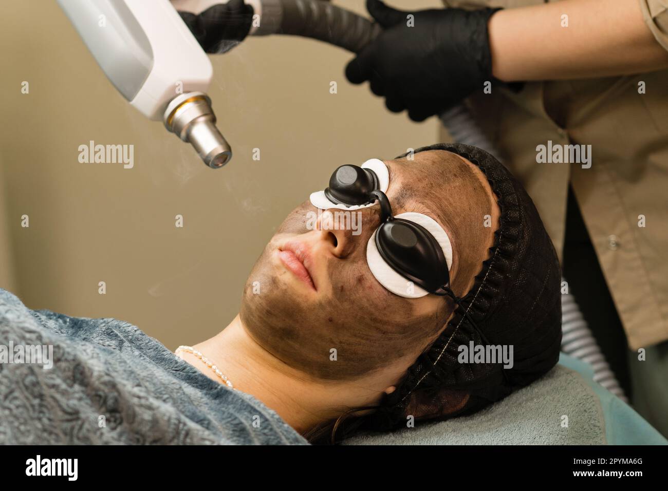 Carbon face peeling procedure in beauty salon. Laser pulses clean skin ...