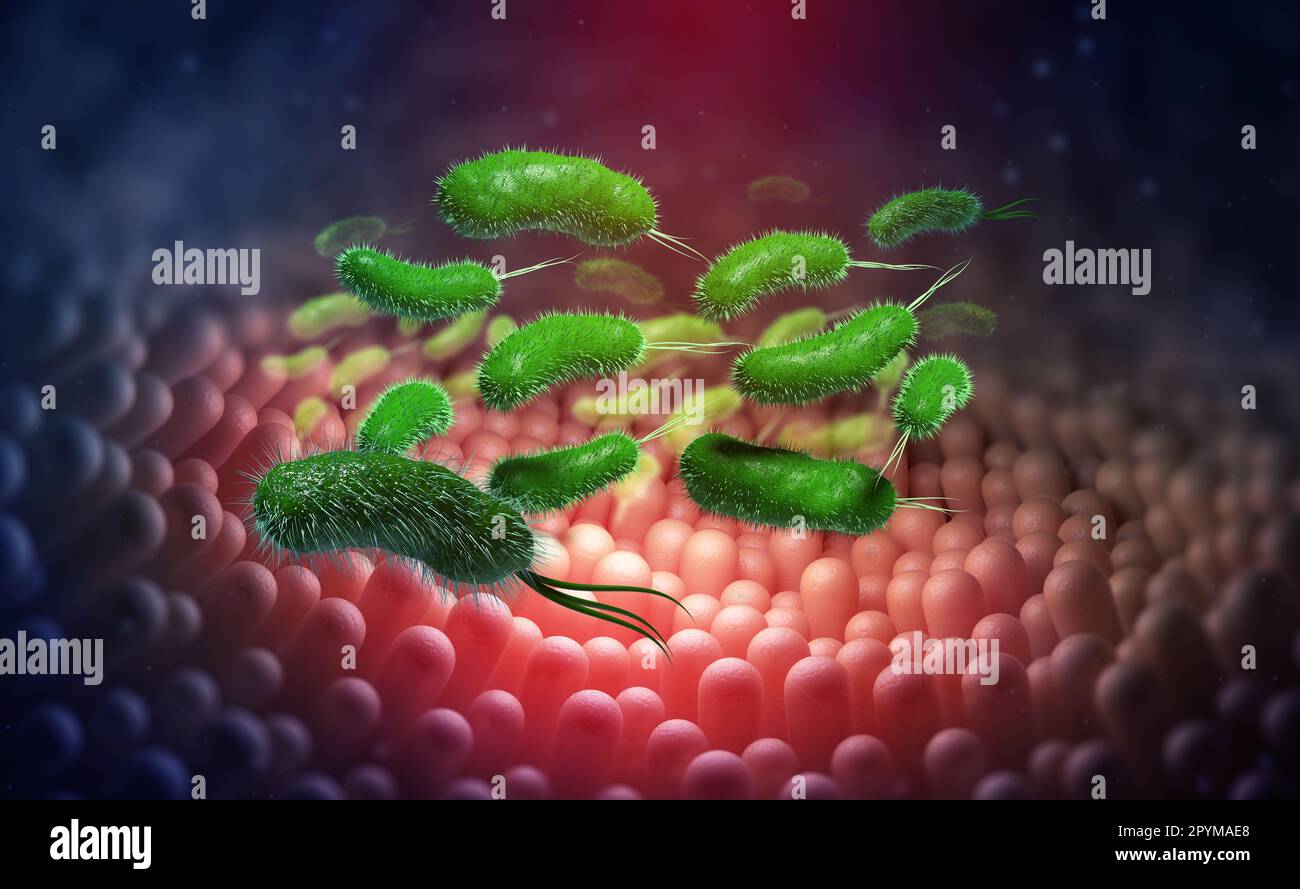 Bowel infection, upset stomach, germs and viruses in body. Intestinal ...