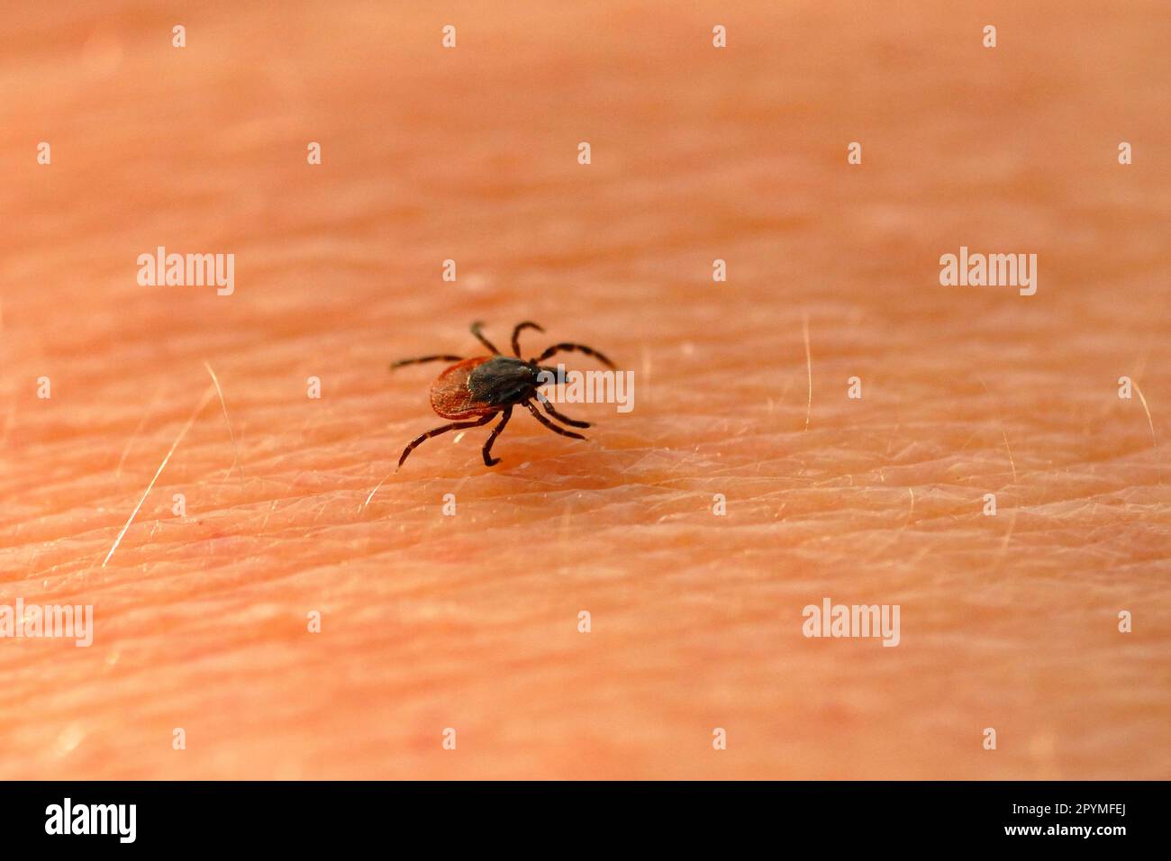 Adult tick hi-res stock photography and images - Alamy