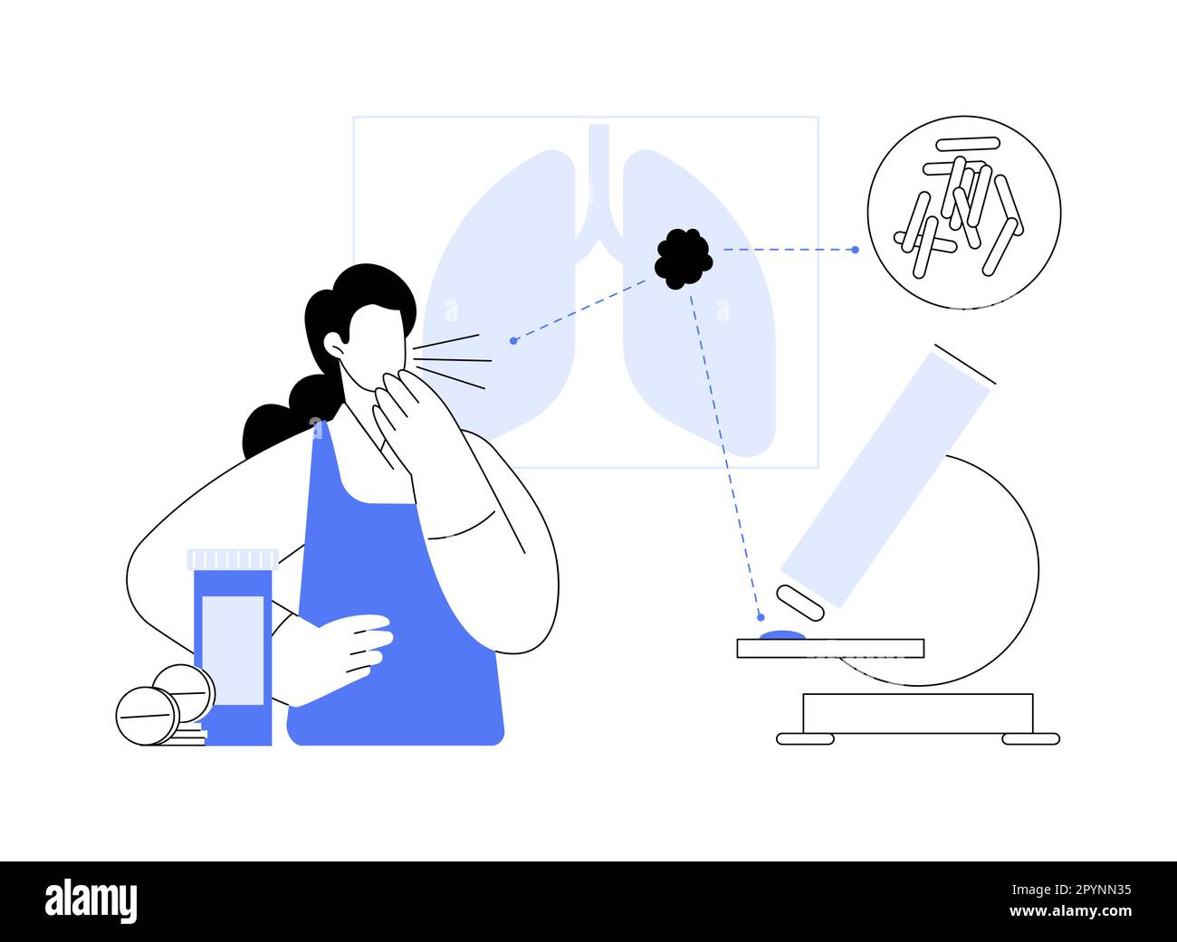 Tuberculosis abstract concept vector illustration Stock Vector Image ...