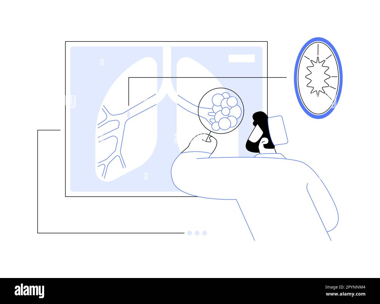 Chronic obstructive pulmonary disease abstract concept vector ...