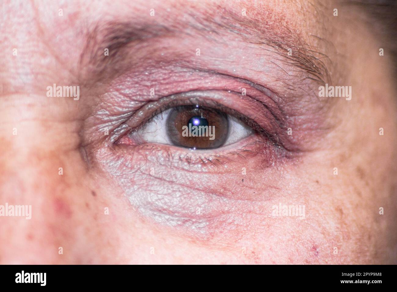An up-close photograph of a human eye, featuring a combination of gray ...