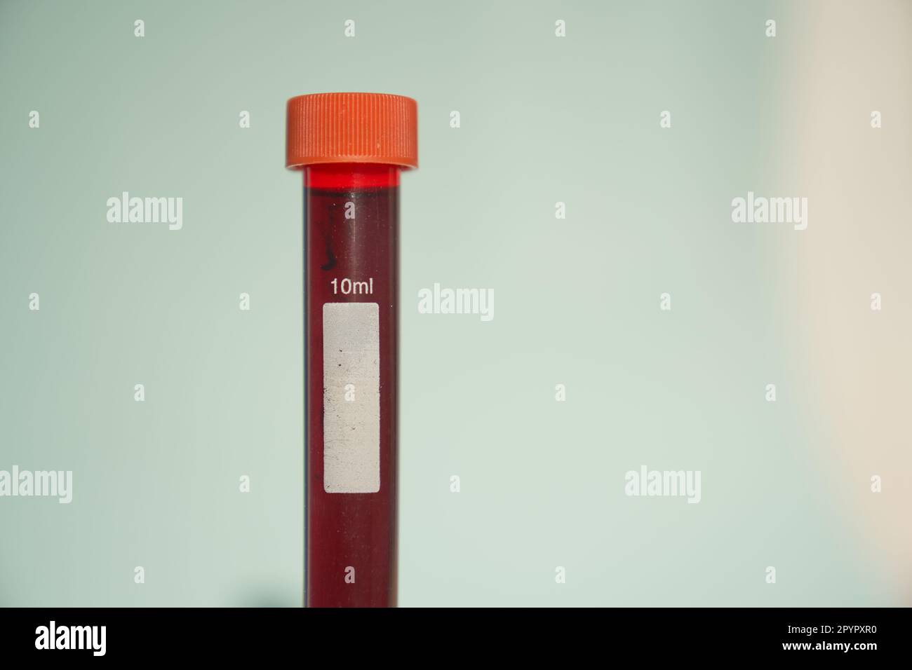 A sample of human blood in a test tube in a medical laboratory, ready ...