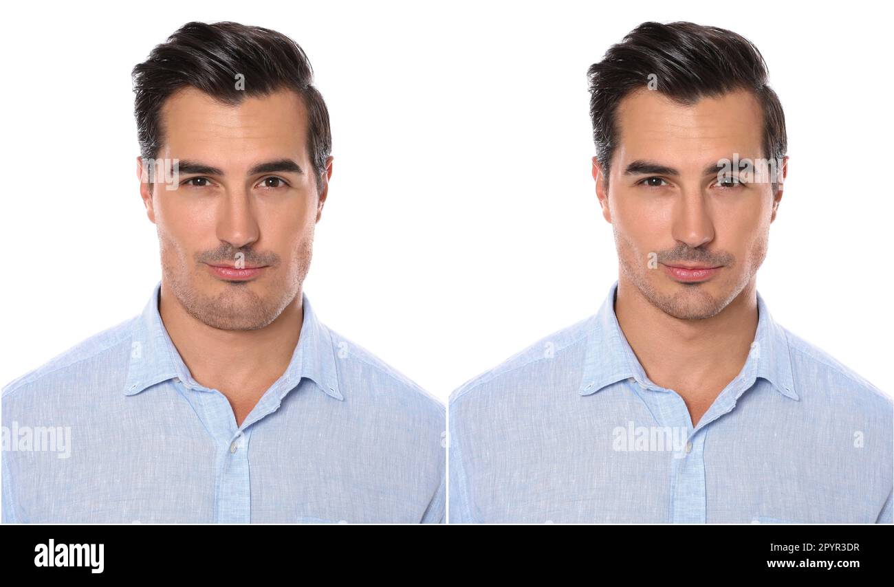 Double chin problem. Collage with photos of man before and after ...