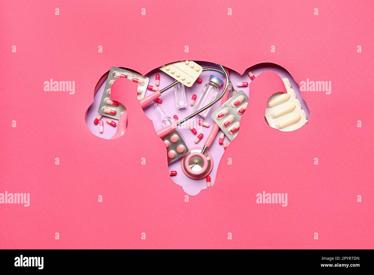 Hormonal medications visible through cut pink paper in shape of uterus ...