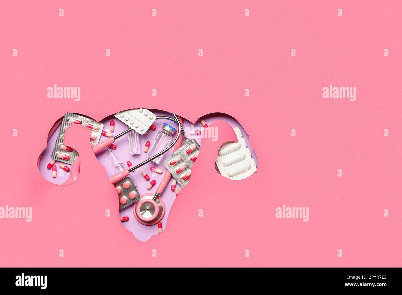 Hormonal medications visible through cut pink paper in shape of uterus ...