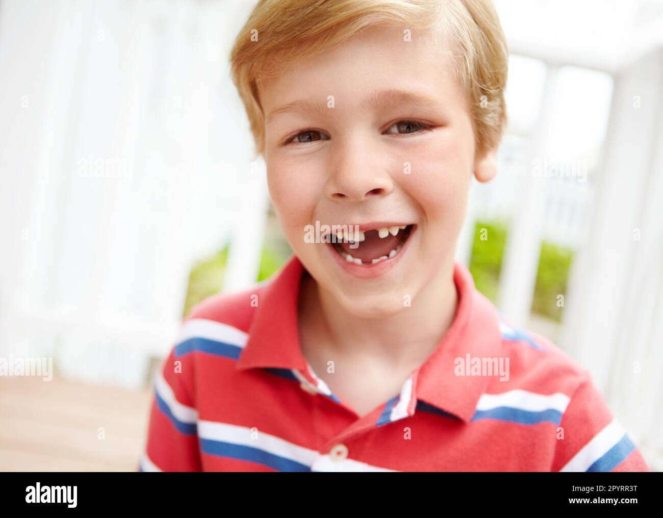 I lost another tooth. A young boy smiling at you with a missing tooth Stock Photo - Alamy