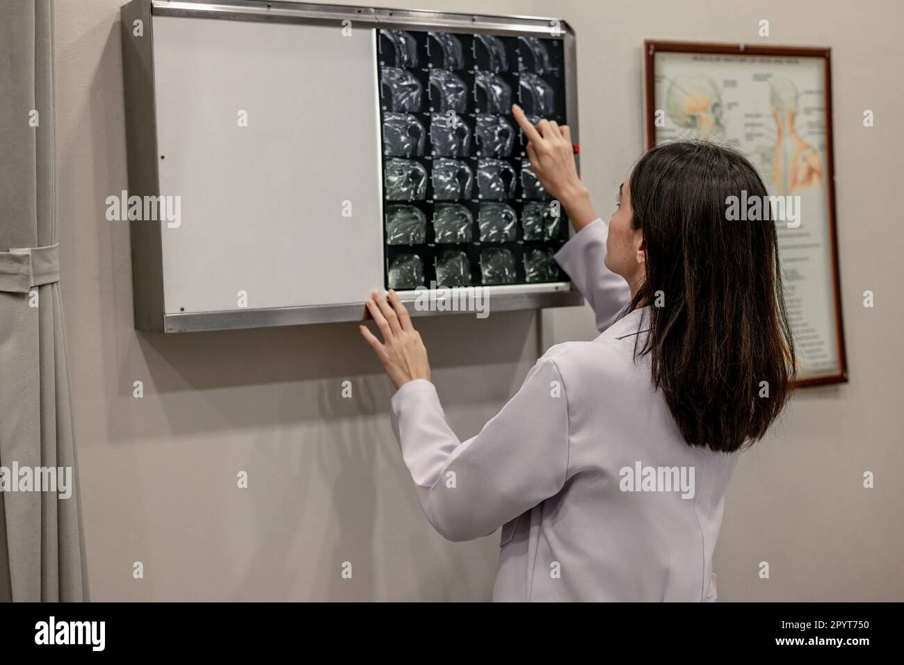 Physician and radiologist analyze medical images, including MRI film ...