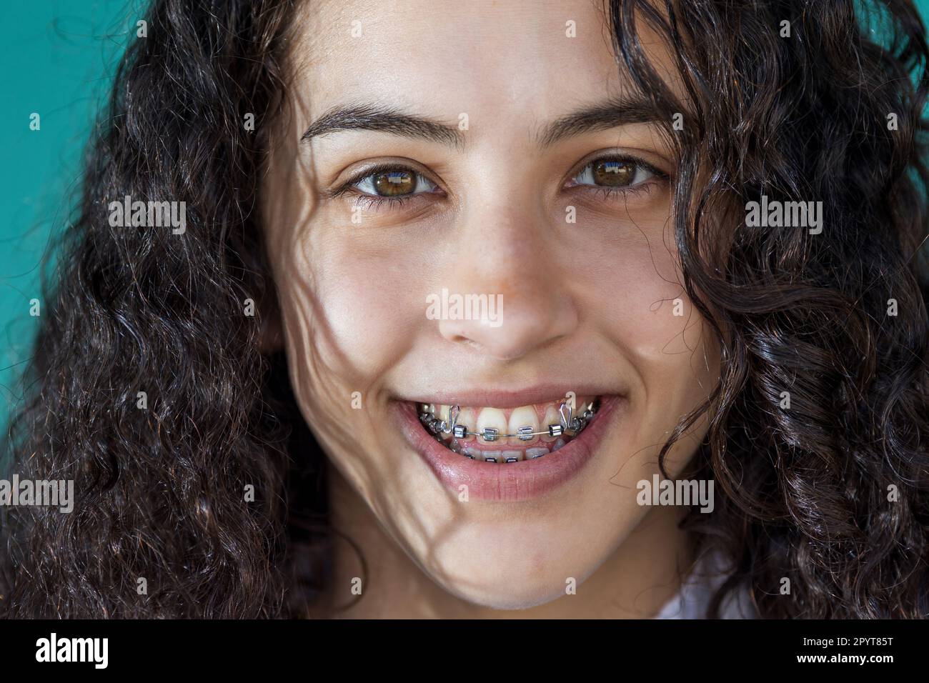 Portrait of pretty girl with curly hair smiling and showing metal braces on teeth Stock Photo ...