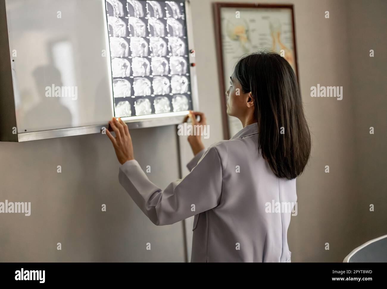 Physician and radiologist analyze medical images, including MRI film ...