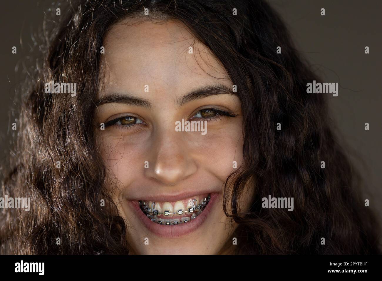 Portrait of pretty girl with curly hair smiling and showing metal braces on teeth Stock Photo ...