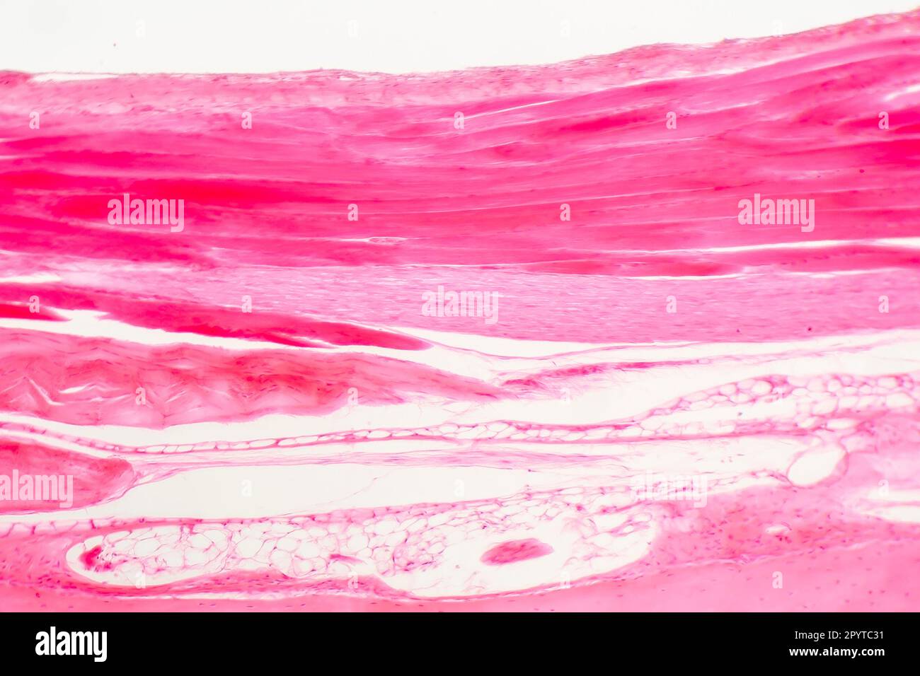 Specialized Connective Tissue Dense
