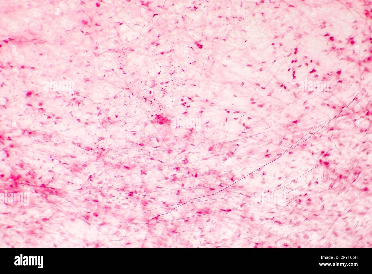 Human loose connective tissue, light photomicrograph, hematoxylin and ...