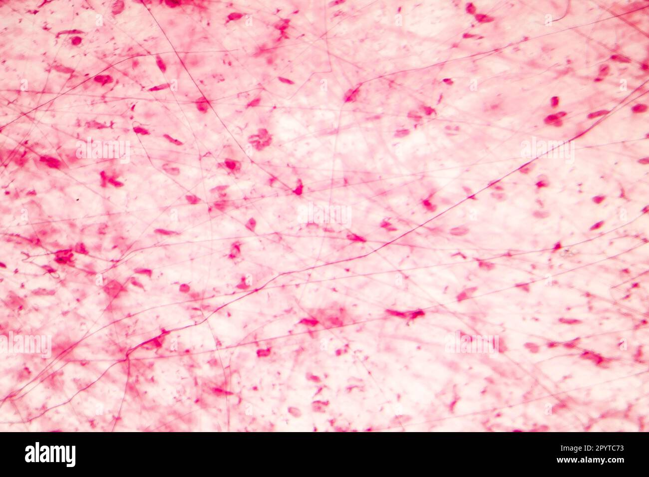 Human loose connective tissue, light photomicrograph, hematoxylin and ...